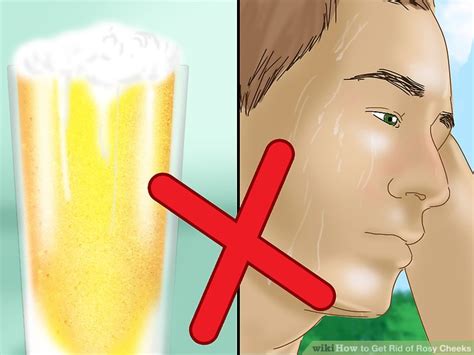 How To Get Rid Of Rosy Cheeks Steps With Pictures WikiHow Health