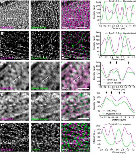 Tpm3132 Overlaps With Non Muscle Myosin Ii Heads But Not With