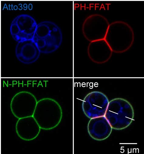 An Intrinsically Disordered Region In Osbp Acts As An Entropic Barrier