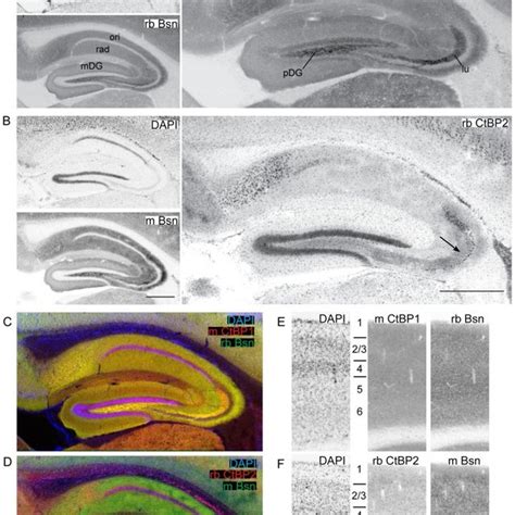 The Sagittal Slices Of Adult Mouse Brain Were Stained With Antibody Download Scientific Diagram
