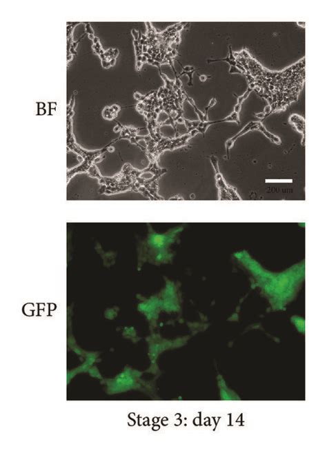 Selective Differentiation Of IPS Cells Into Insulin Producing Download Scientific Diagram