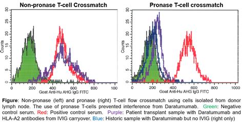 Use Of Pronase To Identify Hla Crossmatch Antibody Interference Atc Abstracts