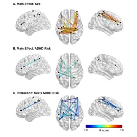 Significant Effects Of ADHD Risk And Sex On FC Download Scientific Diagram