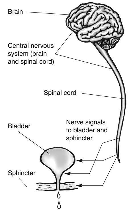 Neurogenic Bladder Over Tiem Online