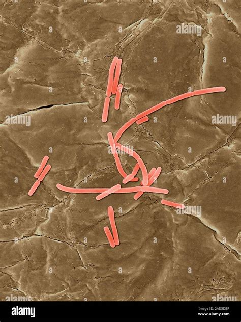Coloured Scanning Electron Micrograph Sem Of Bacillus Anthracis Vegetative Stage