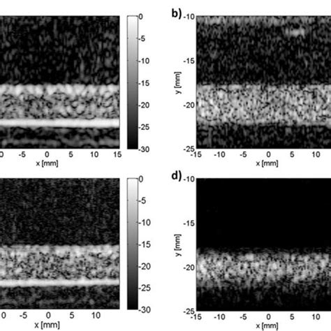 Linear Ultrasound Images Of A Flow Phantom Filled With Circulating Download Scientific Diagram