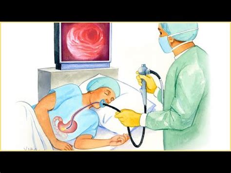 What Is The Cpt Code For Upper Gastrointestinal Endoscopy