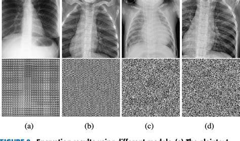 Figure 8 From A Novel Medical Image Encryption Scheme Based On Deep