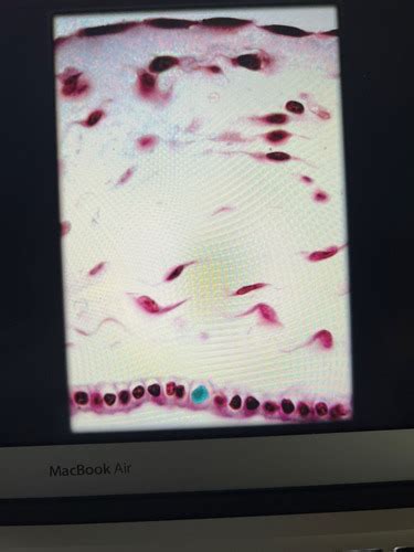 Lab Flashcards Quizlet