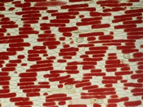 Plasmolysis In Tulip Cells Stock Video Clip K004 2361 Science Photo Library