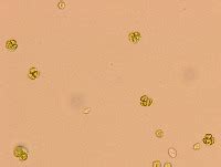 CellDetection Roboflow Universe