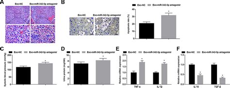 Inhibited Exosomal Mir 342 5p From Hucmscs Promotes Pe Progression A