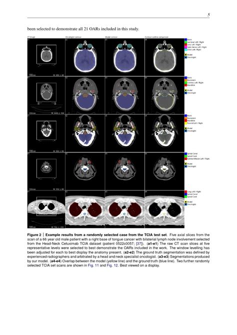 Deep Learning To Achieve Clinically Applicable Segmentation Of Head And Neck Anatomy For