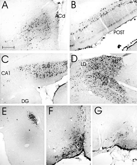 Seven Photomicrographs Ag Demonstrating The Pattern Of Retrograde