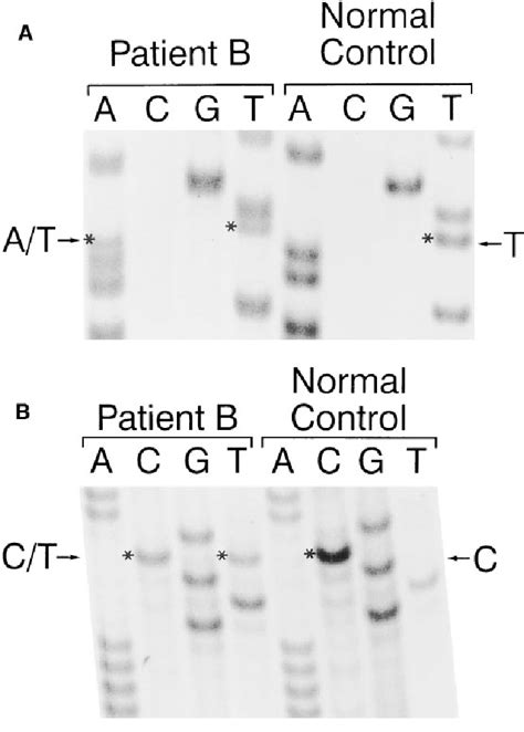 Delineation Of Exon Mutations In Patient B Direct Sequence Analysis Download Scientific