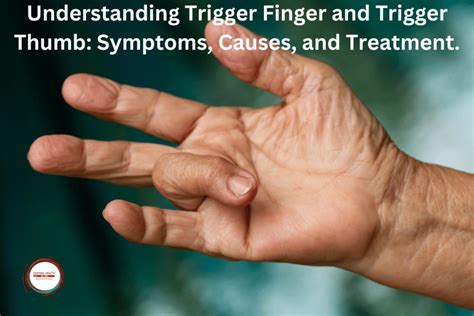Understanding Trigger Finger And Trigger Thumb Symptoms Causes And Treatment Central Health