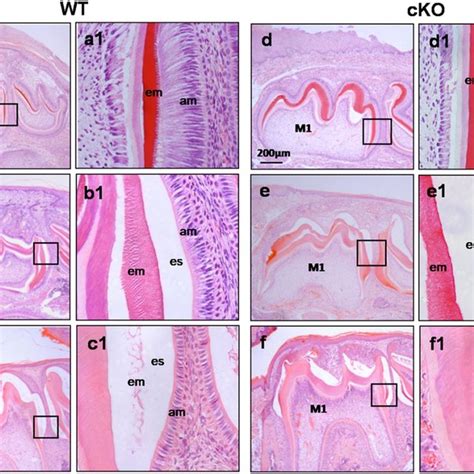 Pdf Ablation Of Runx2 In Ameloblasts Suppresses Enamel Maturation In