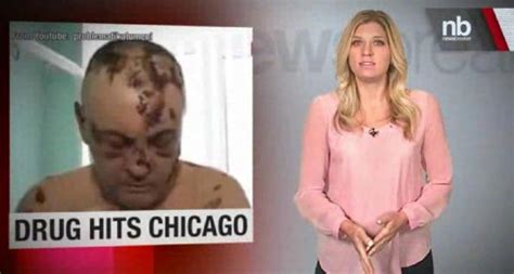 Krokodil Before And After