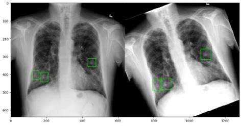Sample Of Data Augmentation Technique With Rotate 45° Download