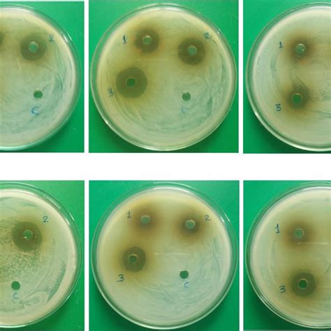 Zone Of Inhibition Of Fungal Bioactive Compounds Against Pathogenic