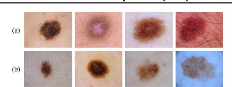 Figure 1 From The Forward Forward Algorithm As A Feature Extractor For