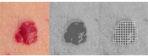 An Example Of Clustering And Blocks Extracting Of Roi Download Scientific Diagram