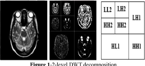 figure 1 2 from medical image compression and encryption using adaptive arithmetic coding
