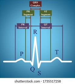 Pr Interval Images Stock Photos Vectors Shutterstock