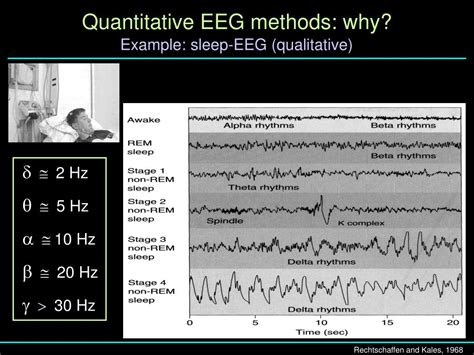 Ppt Quantitative Analysis Of Electroencephalographic Eeg Signals