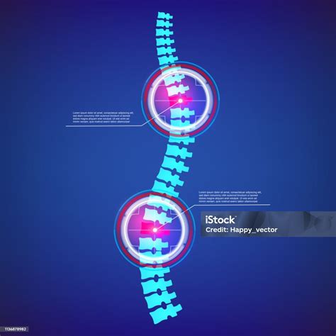 배경에서 척추 X 선 통증 목 디스크 성능 저하 부상 치료의 창조적 인 벡터 일러스트 예술 디자인 의료 배너 템플릿입니다