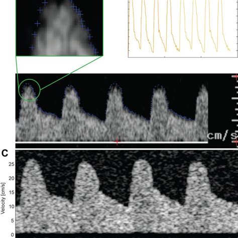 Depiction Of How Doppler Spectra Were Traced And Regenerated A The