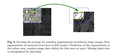 Semantic Segmentation Unet Unet By Abhishek Kumar Medium