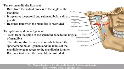 Condylar Fracturepptx