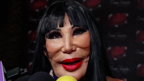 Lyn May And The Heartbreaking Story Behind Her Changed Appearance