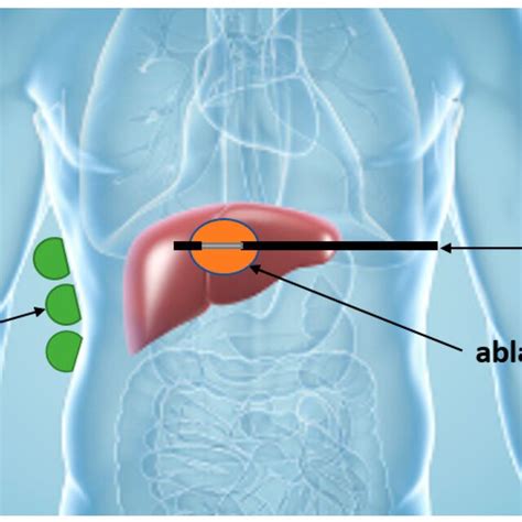 Representation Of The Permittivity Distribution In Different Regions Of