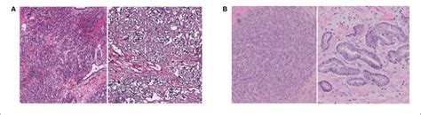Figure 1 From Unsupervised Domain Adaptation For Classification Of