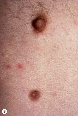 Developmental Anomalies Clinical Gate
