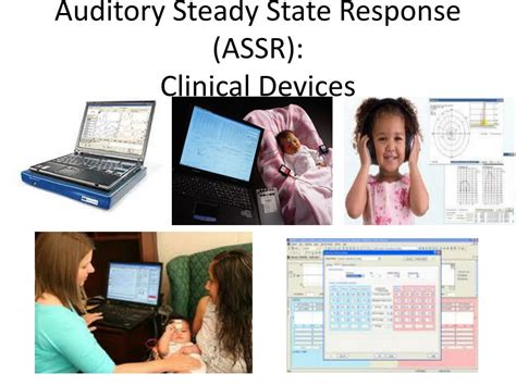 Ppt Limitation Of Click Evoked Abr Lack Of Frequency Specificity