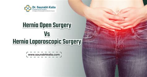 Hernia Open Surgery Vs Hernia Laparoscopic Surgery A Comparative Guide