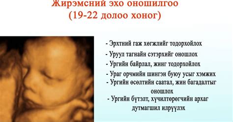 Suldnews Mn Жирэмсний үед хийх хэт авианы шинжилгээ буюу эхо Ерөнхий Өнөөдөр хөл хүнд болсон