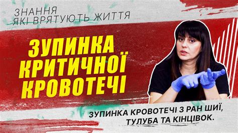 Зупинка критичної кровотечі Перша домедична допомога Youtube