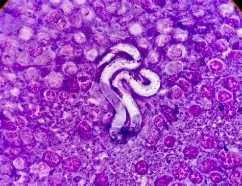 15 Types Of Worms Species Facts And Photos