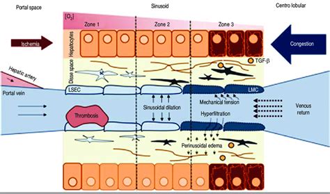 Pathophysiology Of Fald Lsec Liver Sinusoidal Endothelial Cell Sc