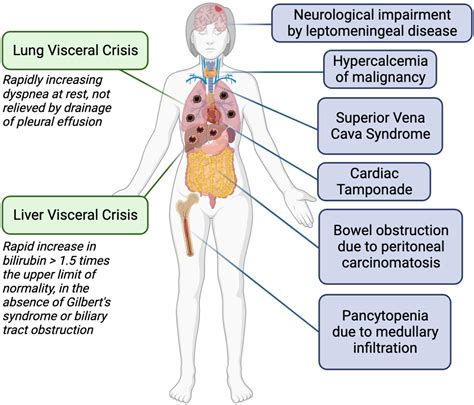 Visceral Crisis In Metastatic Breast Cancer An Old Concept With New