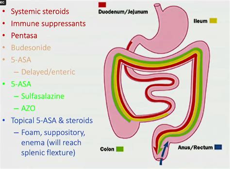 IBD Diagram Quizlet