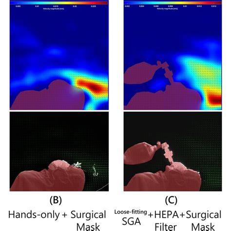 Aerosol Movement With Velocity Vector Green Arrows Under Particle Download Scientific Diagram