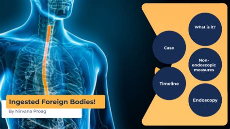 Ingested Foreign Bodies By Gordon Ramsay On Prezi