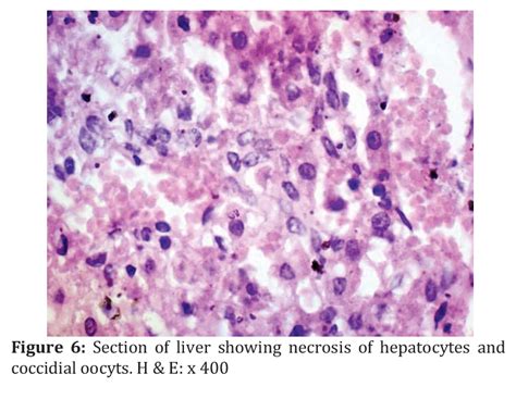 Impression Smear Of Liver Showing Numerous Cholangiocytes Leishmans Download Scientific