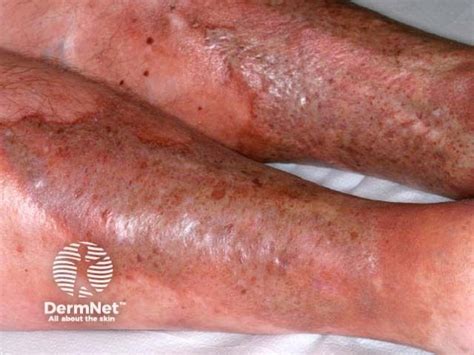 Pin On Helse Og Trening