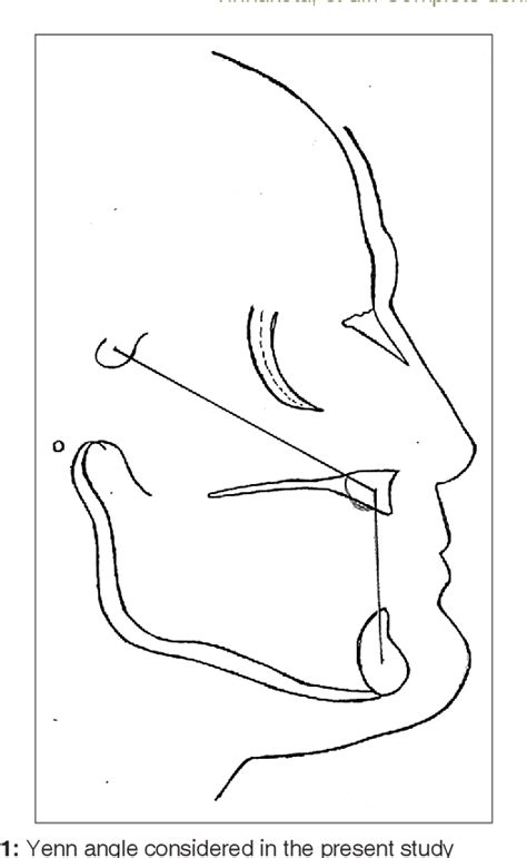 Figure 1 From Comparison Of Patient Satisfaction Between Complete